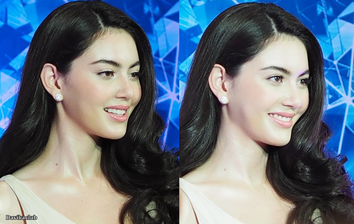 Hoorne Davika Plastic Surgery